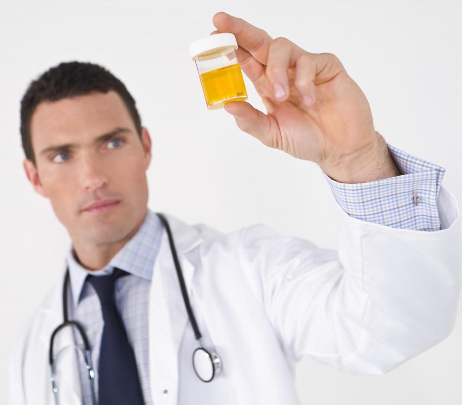 What Is the Role of Diuretics in Sport? (with pictures)